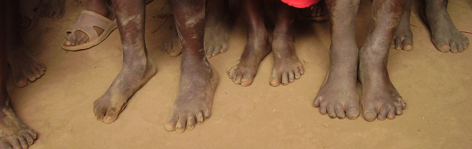 Getting the jump on jiggers | johnageddes